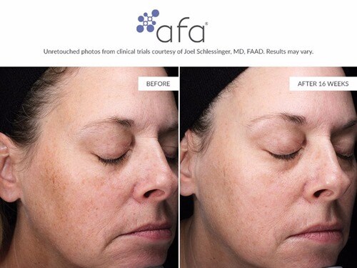 afa Restorative Gel Plus | LovelySkin