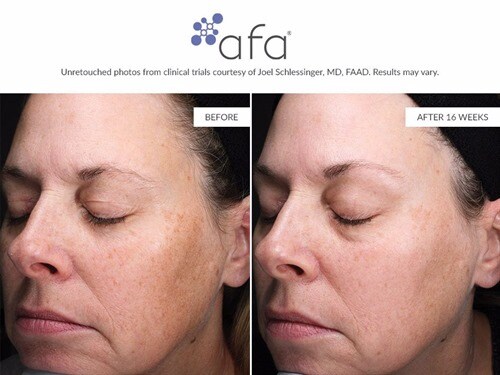 afa Restorative Gel Plus | LovelySkin