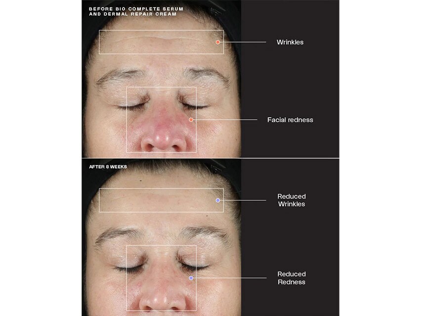 Sentè Bio Complete Serum | Skin Care | LovelySkin