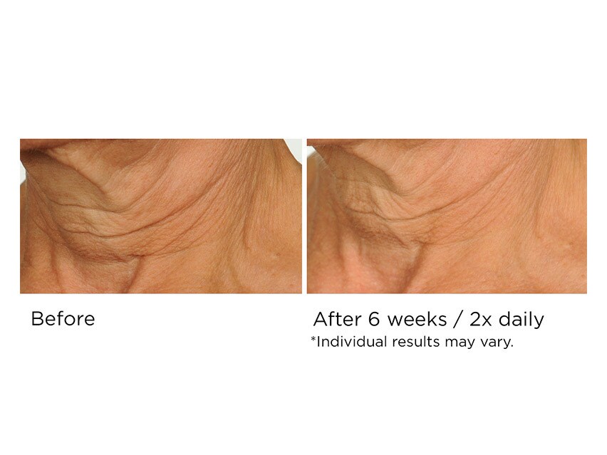 NassifMD® Deco-Lift Neck Firming Complex Serum | LovelySkin