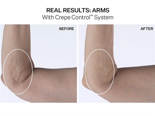 StriVectin Crepe Control Tightening Body Cream | LovelySkin