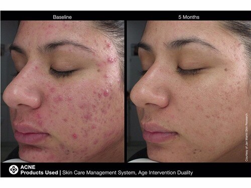 Jan Marini Age Intervention Duality MD | LovelySkin