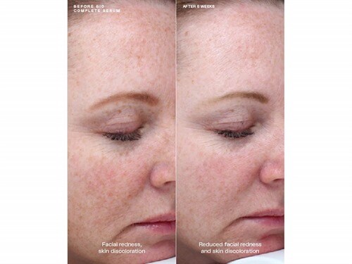 Sentè Bio Complete Serum | Skin Care | LovelySkin