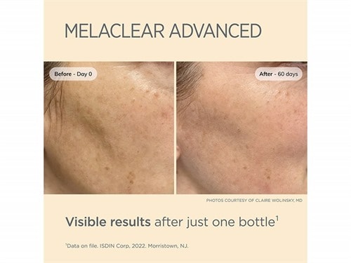 ISDIN Isdinceutics Melaclear Advanced Pigment Perfecting Serum | LovelySkin