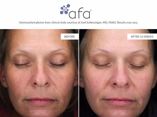 afa Restorative Gel Plus | LovelySkin