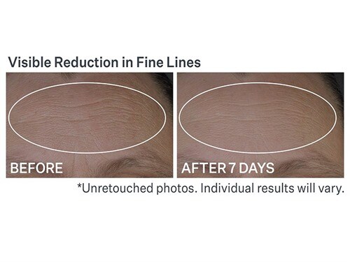 StriVectin Anti-Wrinkle Peptide Plump Line Filling Bounce Serum ...