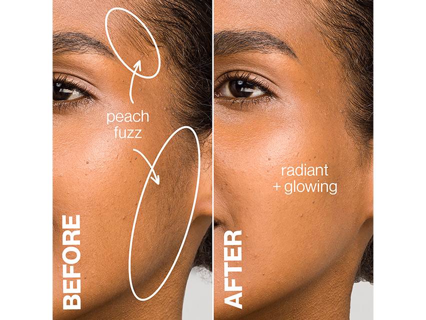 DERMAFLASH 2.0 Facial Exfoliating Device | LovelySkin