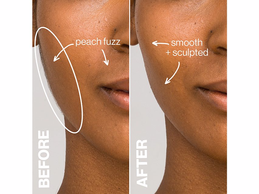 DERMAFLASH 2.0 Facial Exfoliating Device | LovelySkin