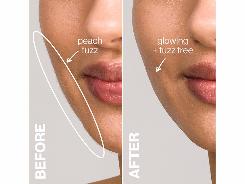 DERMAFLASH 2.0 Facial Exfoliating Device | LovelySkin