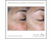 SkinMedica TNS Recovery Complex | LovelySkin