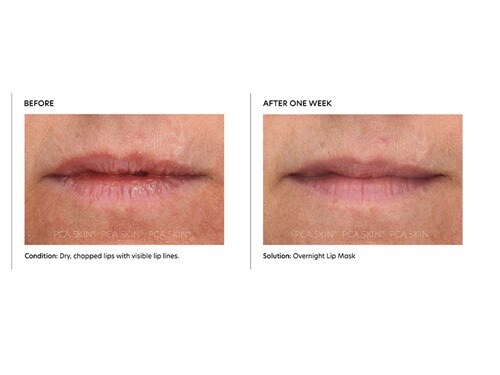 PCA SKIN Hydrating Overnight Lip Mask | LovelySkin